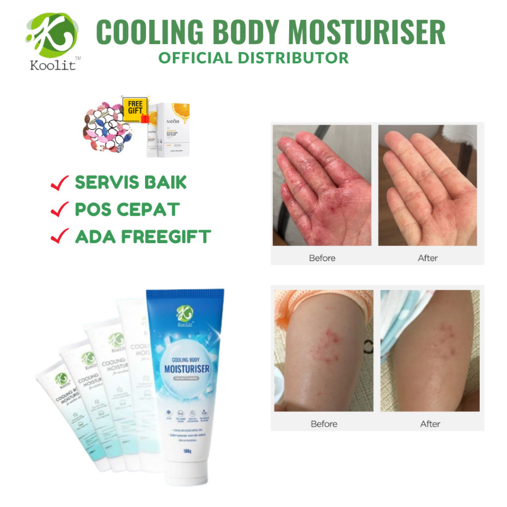 [100% ORIGINAL] KOOLIT COOLING BODY MOISTURISER ECZEMA KULIT GATAL ITCH ...