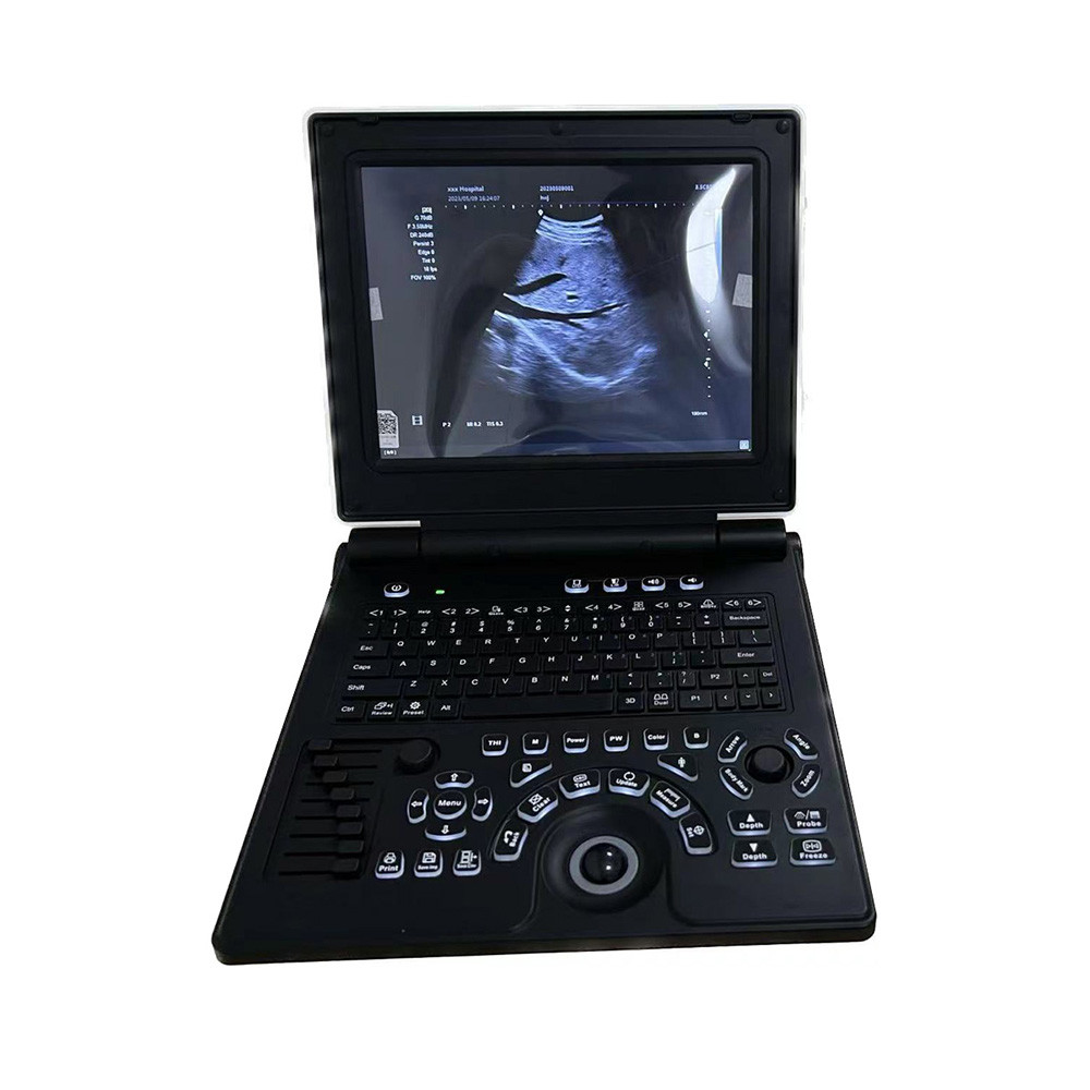 Hospital Portable Color Doppler Echographie 3D 4D Laptop Human Pregnancy Ultrasound Machine ...