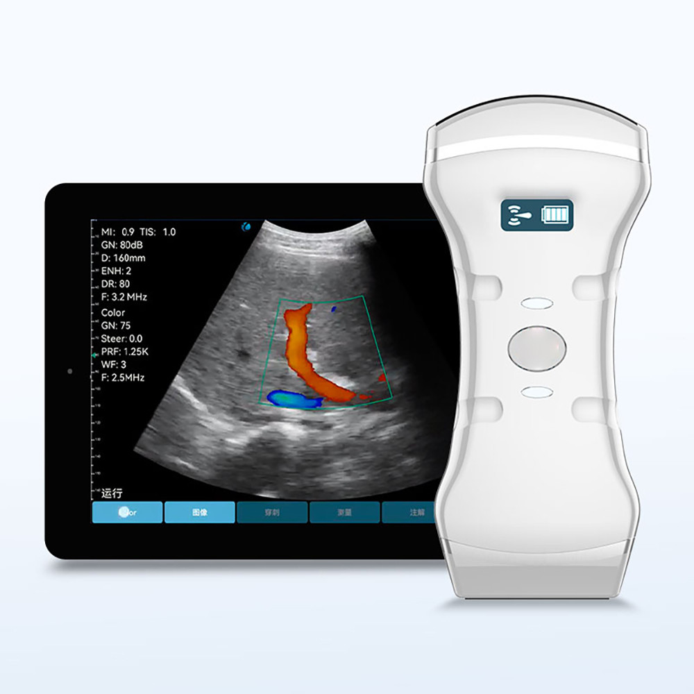 Portable Handheld Convex / Linear Cardiac 3 in 1 Wireless Ultrasound ...