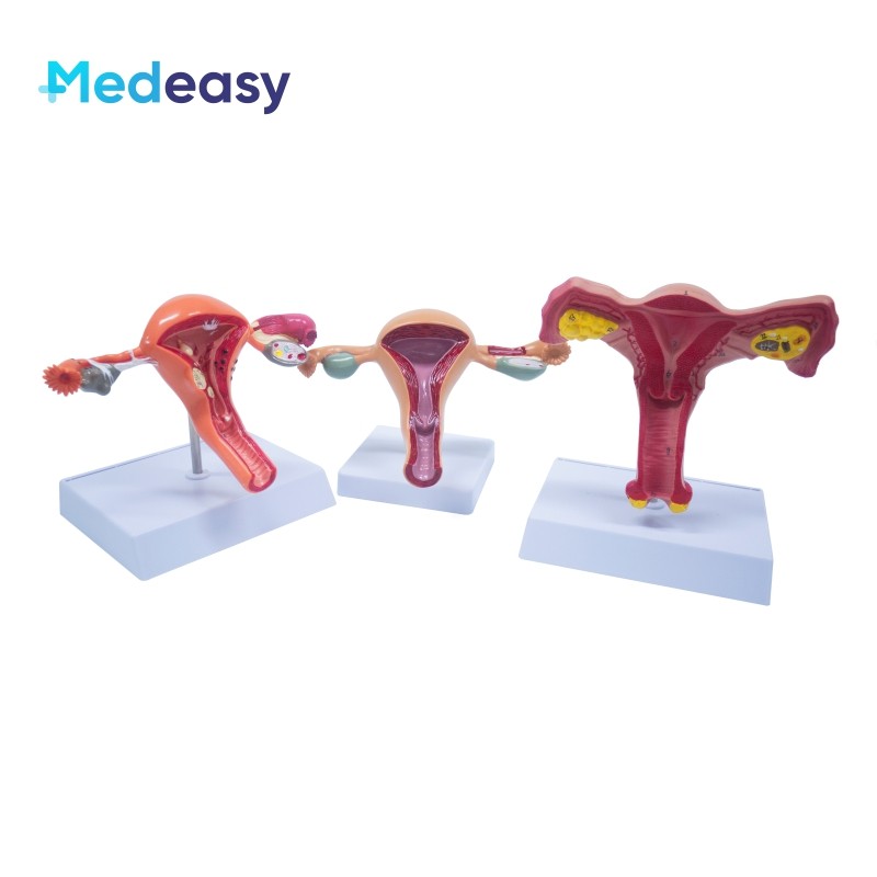 Female Uterus and Ovary Anatomical Model, Vagina Model Plastic Uterus ...