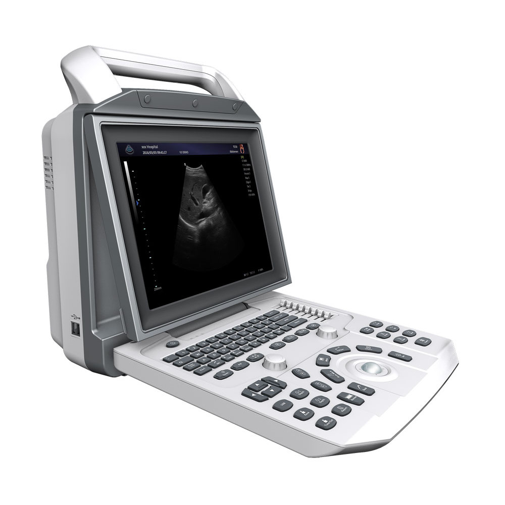 diagnostic ultrasound scanner ultrasound machine 3d 4d portable color doppler ultrasound price ...