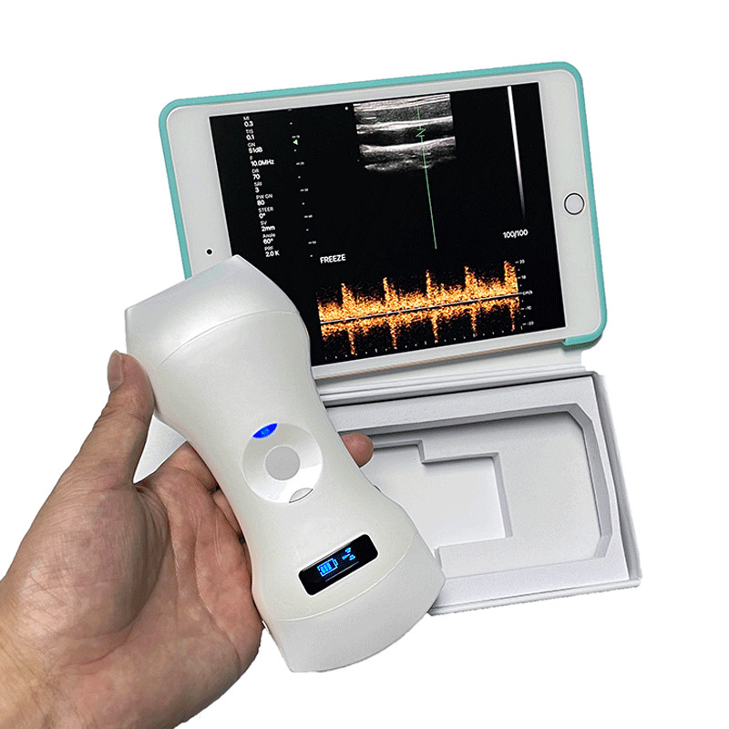 3 In 1 Color Doppler Ultrasound Scanner Phased Array Cardiac, Linear ...