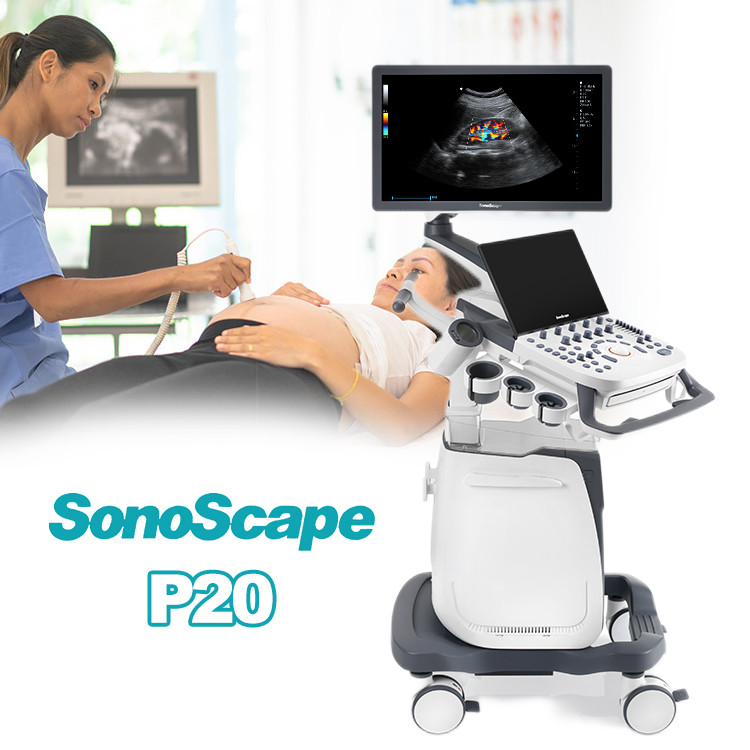 Sonoscape Ultrasound Machine Ecografo Sonoscape P20 4D 5D Trolley Color ...