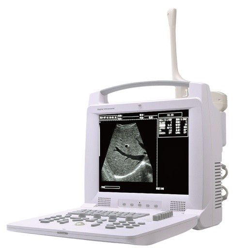Portable Full Digital Ultrasound Scanner Black and White Portable ...