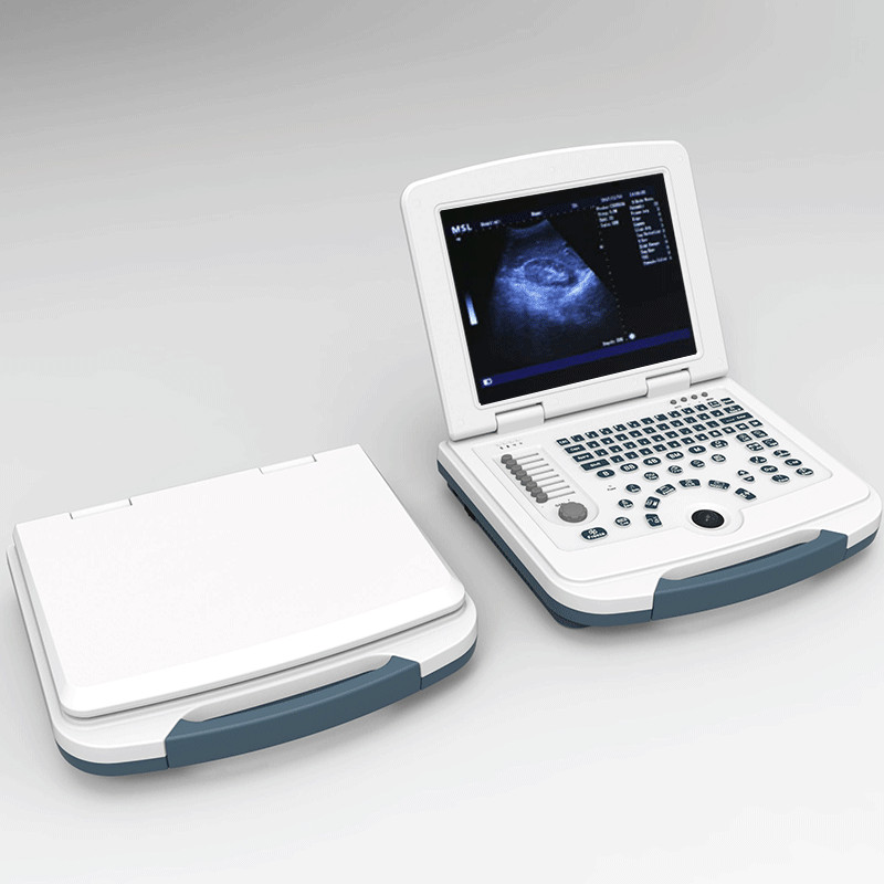Dawei dw-580 portable medical equipos de ultrasonido ecografo ...