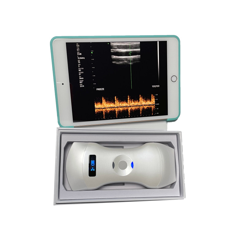 Portable ultrasound wireless color doppler ultrasound scanner for ...