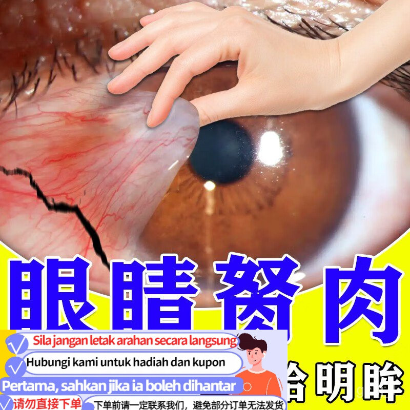 KY-JD Eyes Removing Purplish Red Blood Streaks Eye Drops Blurred Vision ... KY-JD Eyes Removing Purplish Red Blood Streaks Eye Drops Blurred Vision ...