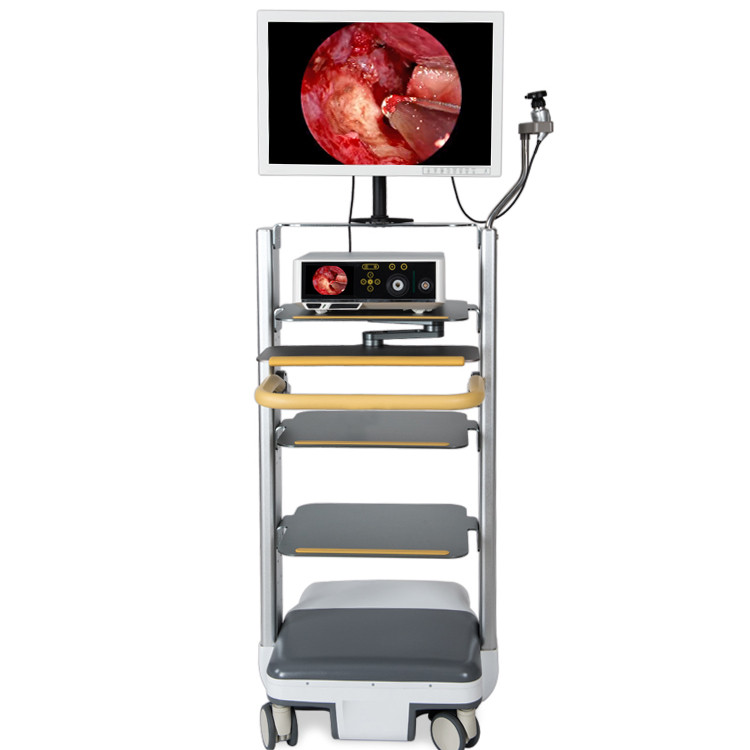 ENT department FHD endoscope camera tower system | Shopee Malaysia