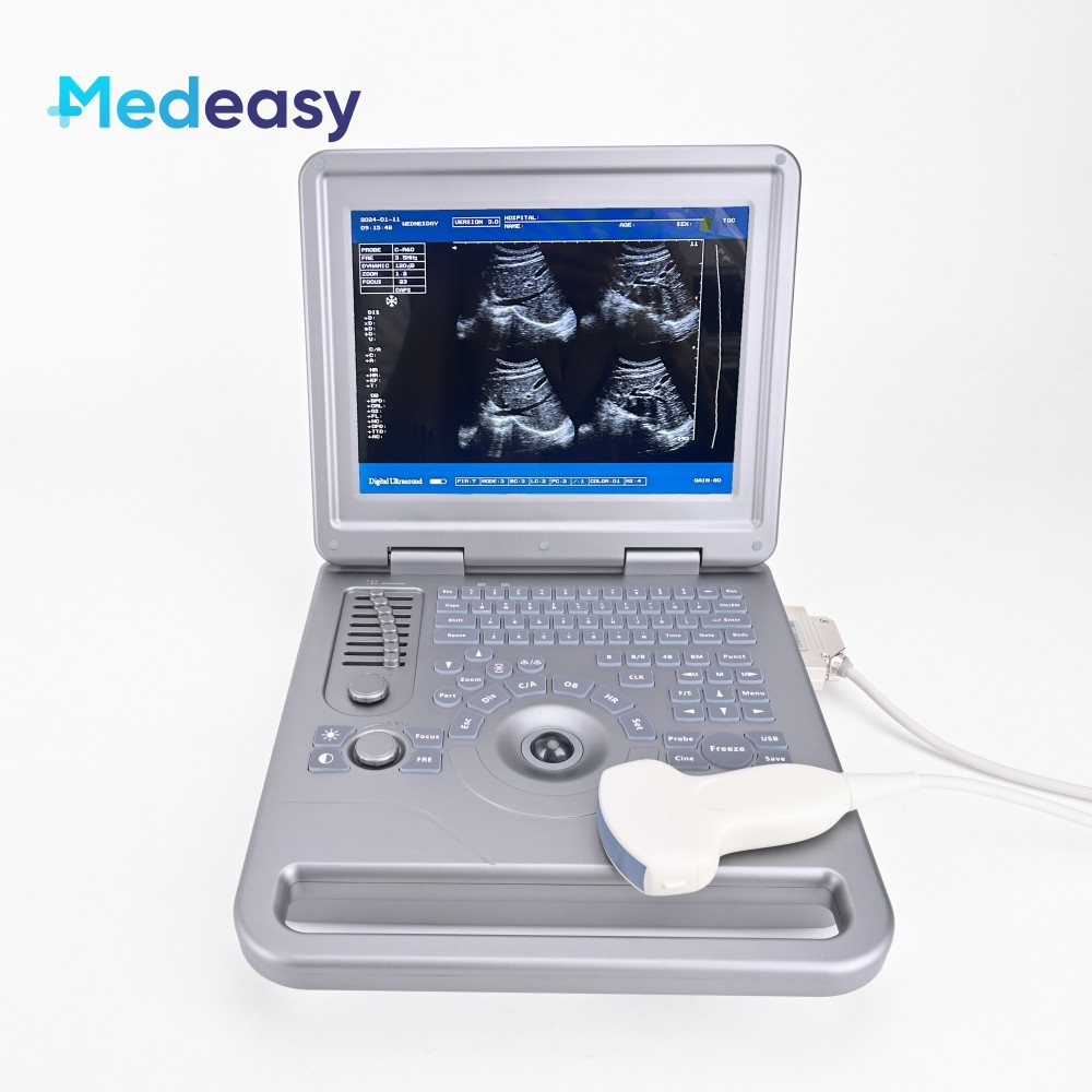 Medical Handheld 12 Inch White and Black Ultrasound Machine Device ...