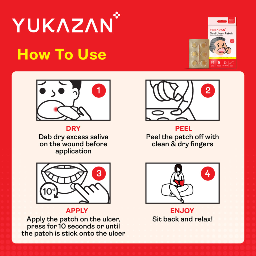Yukazan Oral Ulcer Patch (6 pieces) - For all kind of oral & canker ...