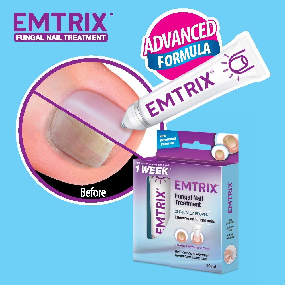 Emtrix Fungal Nail Treatment (10ml) | Shopee Malaysia