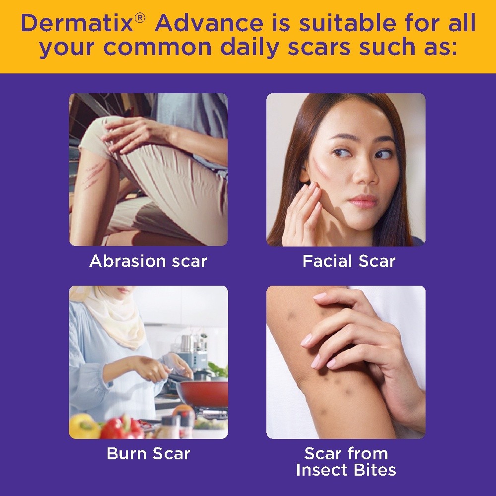 Dermatix Advance Scar Gel 9g | Anti-scar, heal scar treatment, lighten ...