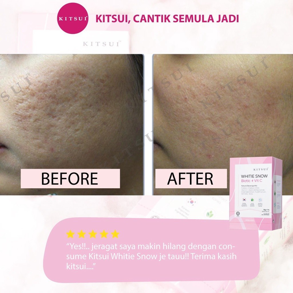 KITSUI Whitie Snow + FREE Sampul Raya x8 | 17's x 15g | Probiotic ...