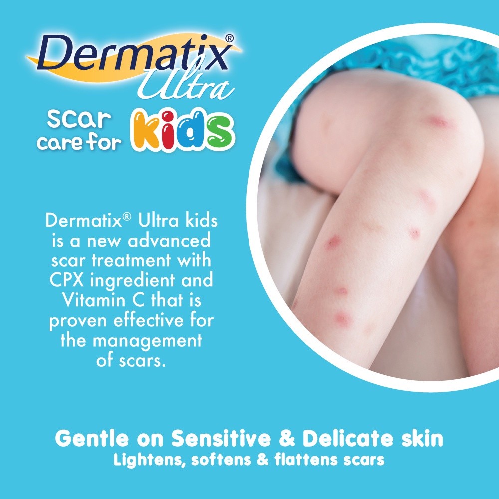 [Value Buy] Dermatix Bundle - Dermatix Ultra Kids 9g + Dermatix Ultra ...