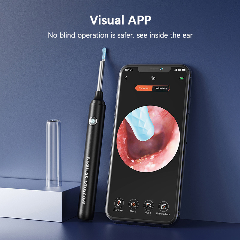 SUNUO Smart Visual Earpick Set With Camera APP HD Otoscope Earwax ...