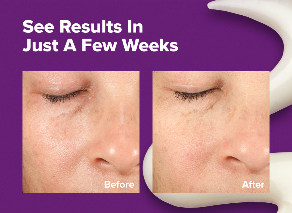 Paula's Choice Clinical Serum Rawatan Diskolorasi - Clinical ...