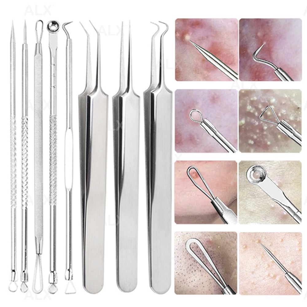 ALX 8 in 1 Stainless Steel Pimple Tools Extractor Needle Blackhead ...