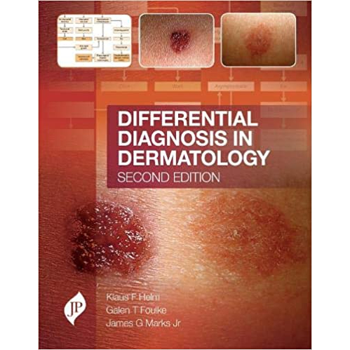 Differential Diagnosis in Dermatology: Second Edition | Shopee Malaysia