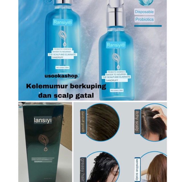 Ubat Kelemumur Kepala Berkuping Scalp Treatment Gatal Kulit Kepala