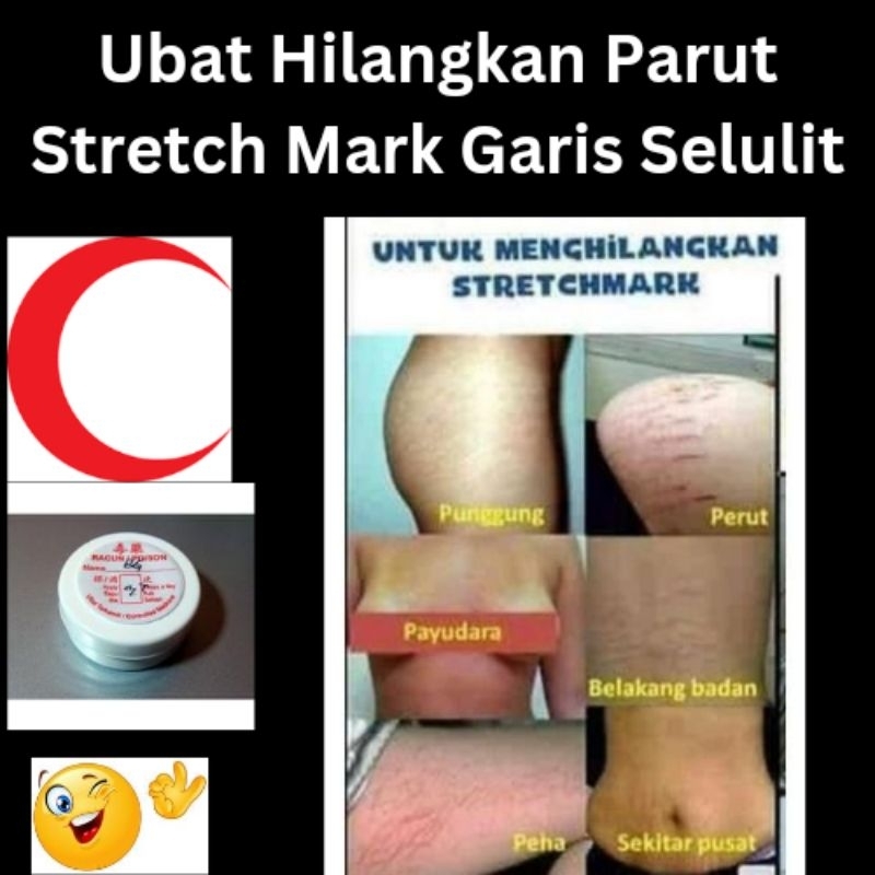 5g Krim Hilang Parut Luka Jahitan Parut Lama Badan Body Scar Removal ...