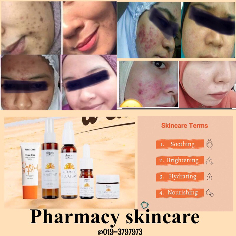 ANNONA SKINCARE SET JERAGAT, JERAWAT, RESDUNG & IMMUNE BOOSTER BEAUTY ...
