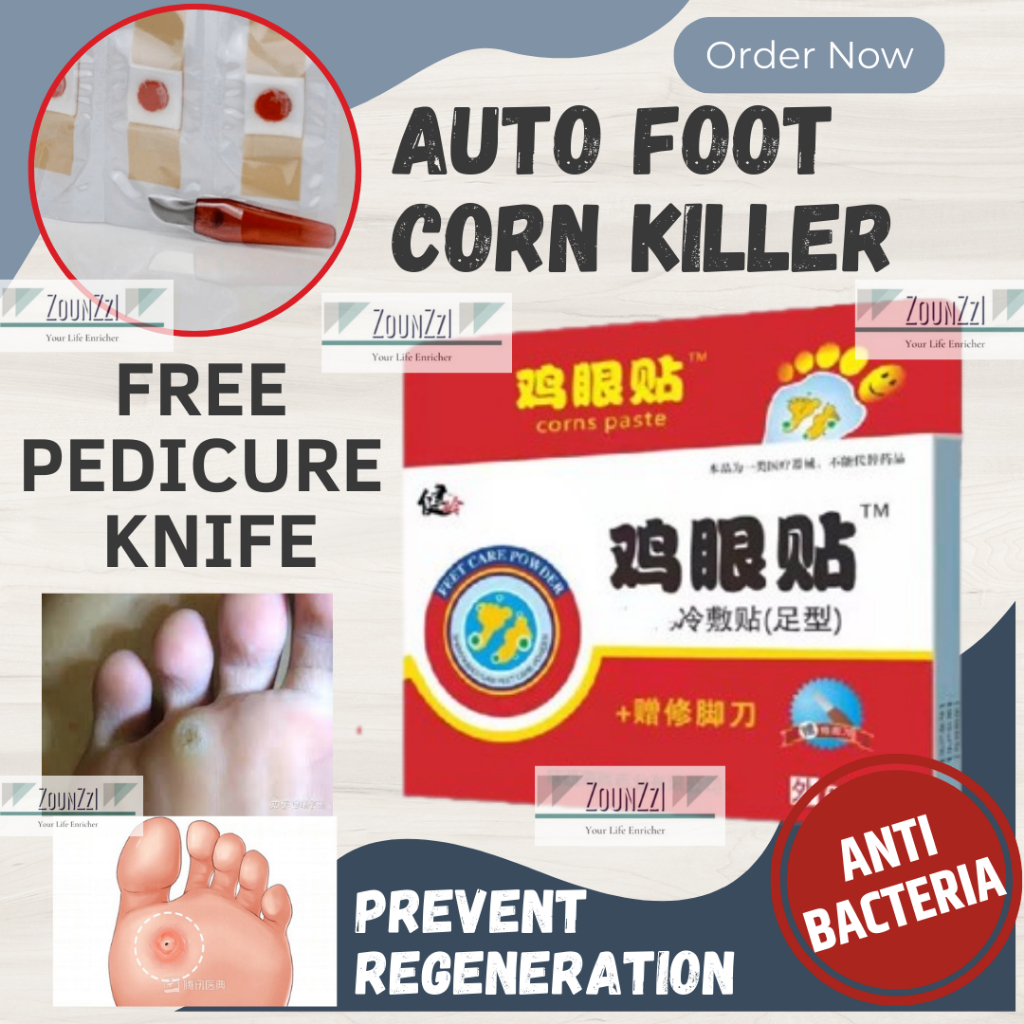 2IN1 Warts Foot Corn Kutil Removal Cream Ointment Ubat Krim Buang ...