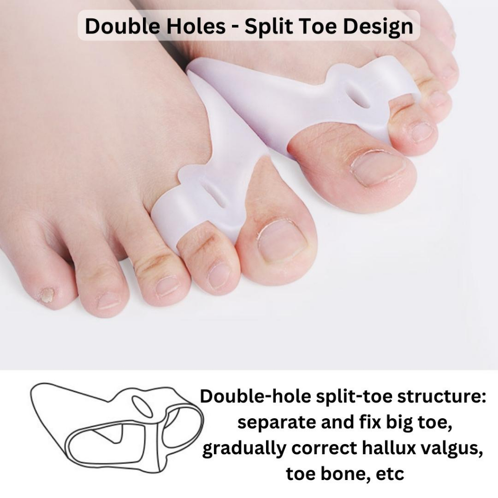 1Pair Big Toe Corrector Bunion Separator Hallux Valgus Spacer ...