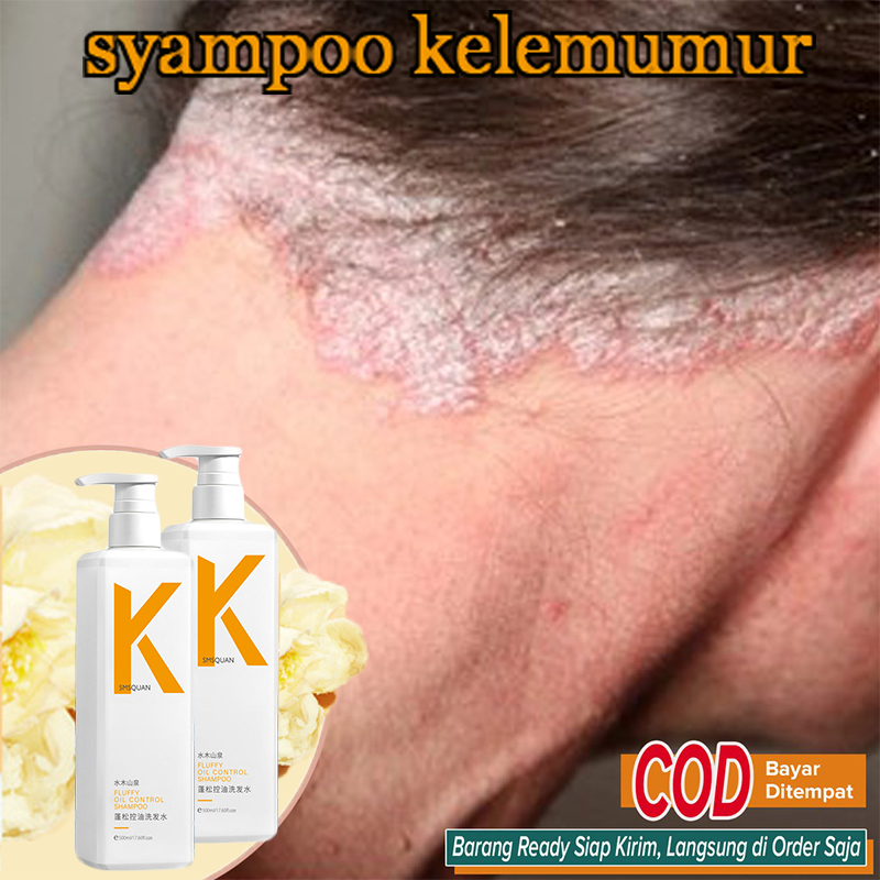 Shampoo kelemumur syampu kutu syampu psoriasis Anti Dandruff Shampoo ...