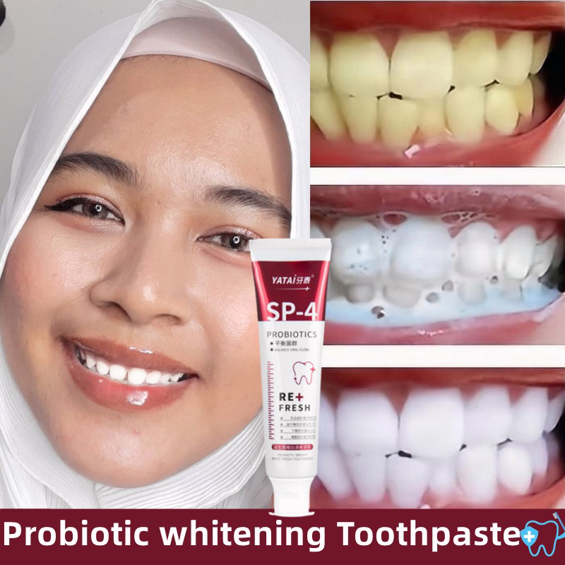 Toothpaste Ubat Gigi Teeth Whitening Probiotic Toothpaste Fresh Breath ...