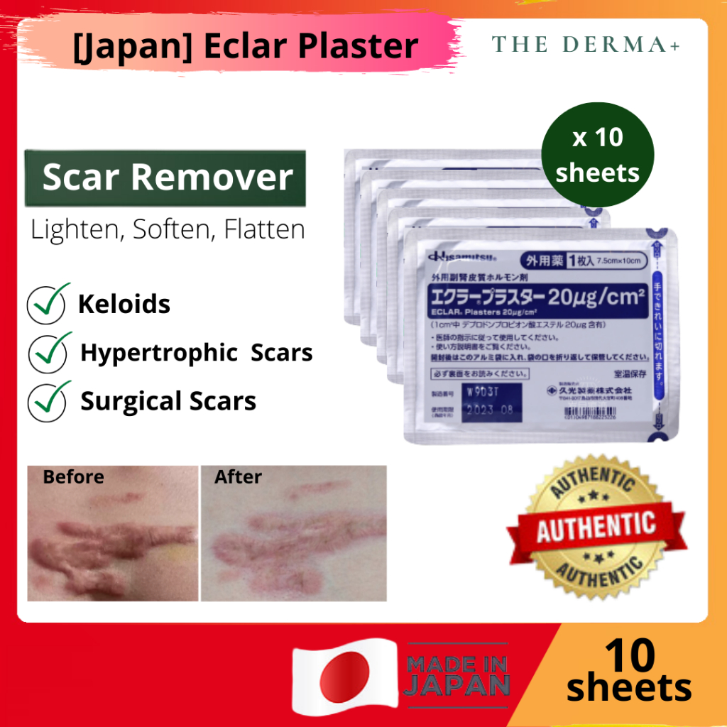 [Japan] Scar Removal / Keloid Treatment - Hisamitsu Eclar Plaster 正品日本久 ...