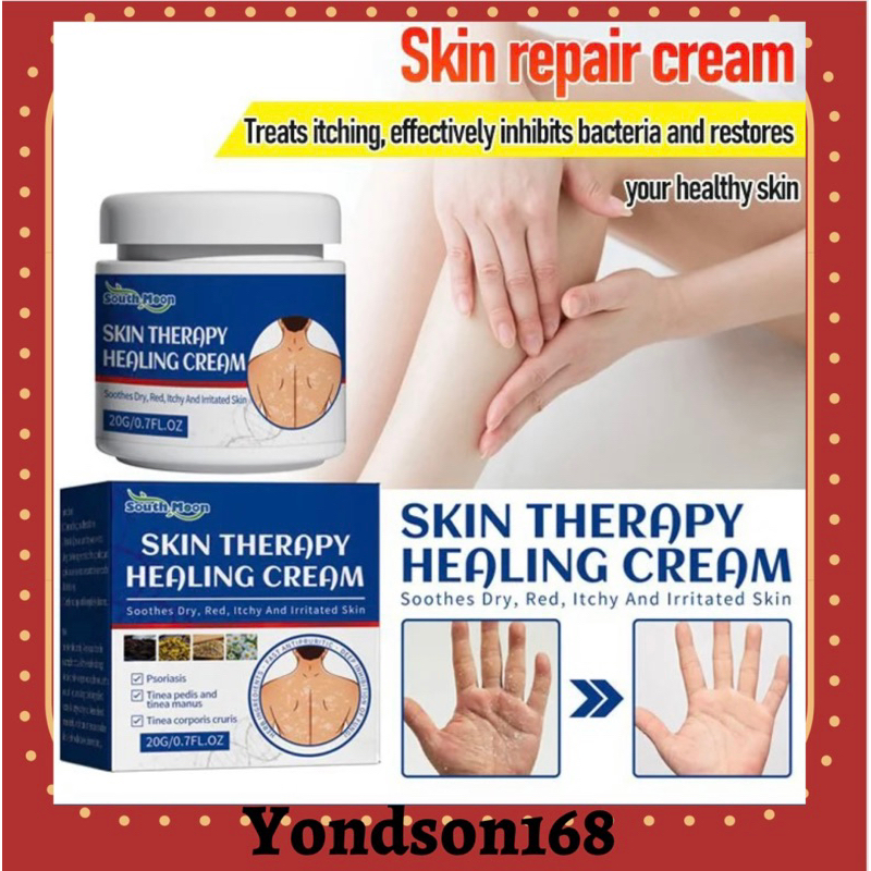 South Moon Skin Therapy Healing Cream Anti Itch Antibacterial Psoriasis
