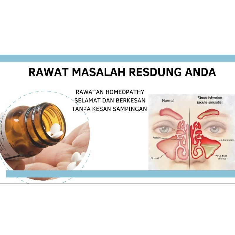 Homepathy- Merawat Masalah Resdung / Sinus | Shopee Malaysia