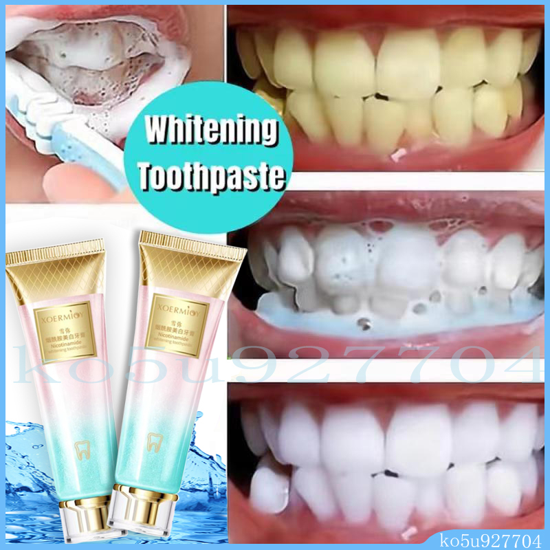 Ubat Gigi Teeth Whitening Gigi Putih Whitening Toothpaste Teeth White ...