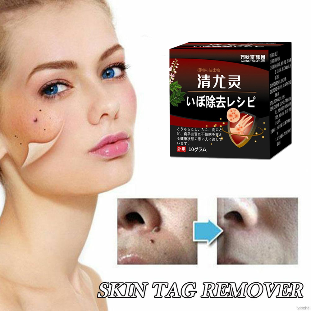 Wart Removal Cream Skin Tag Remover Mole Removal Ketuat Hilangkan ...