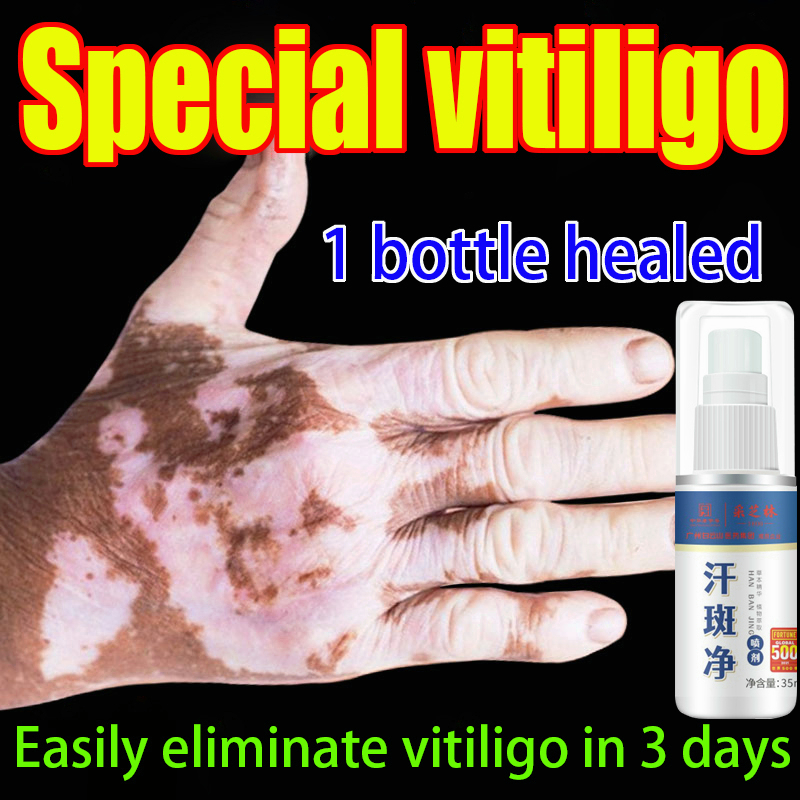 Vitiligo treatment Spray 35ml Melanin Plus Organics bat vitiligo cover ...
