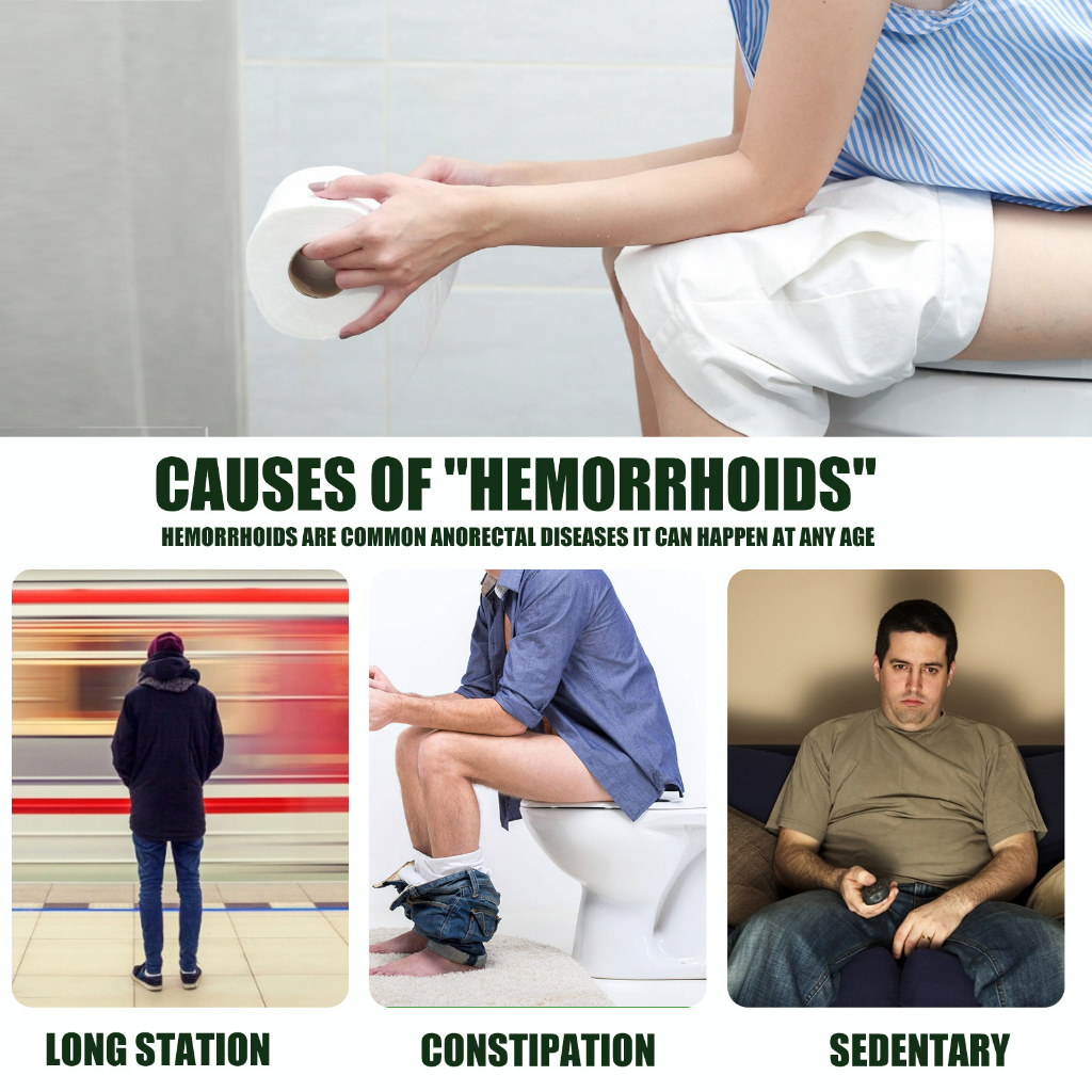 Hemorrhoids cream Krim Buasir Hemorrhoids spray Treatment of mixed ...