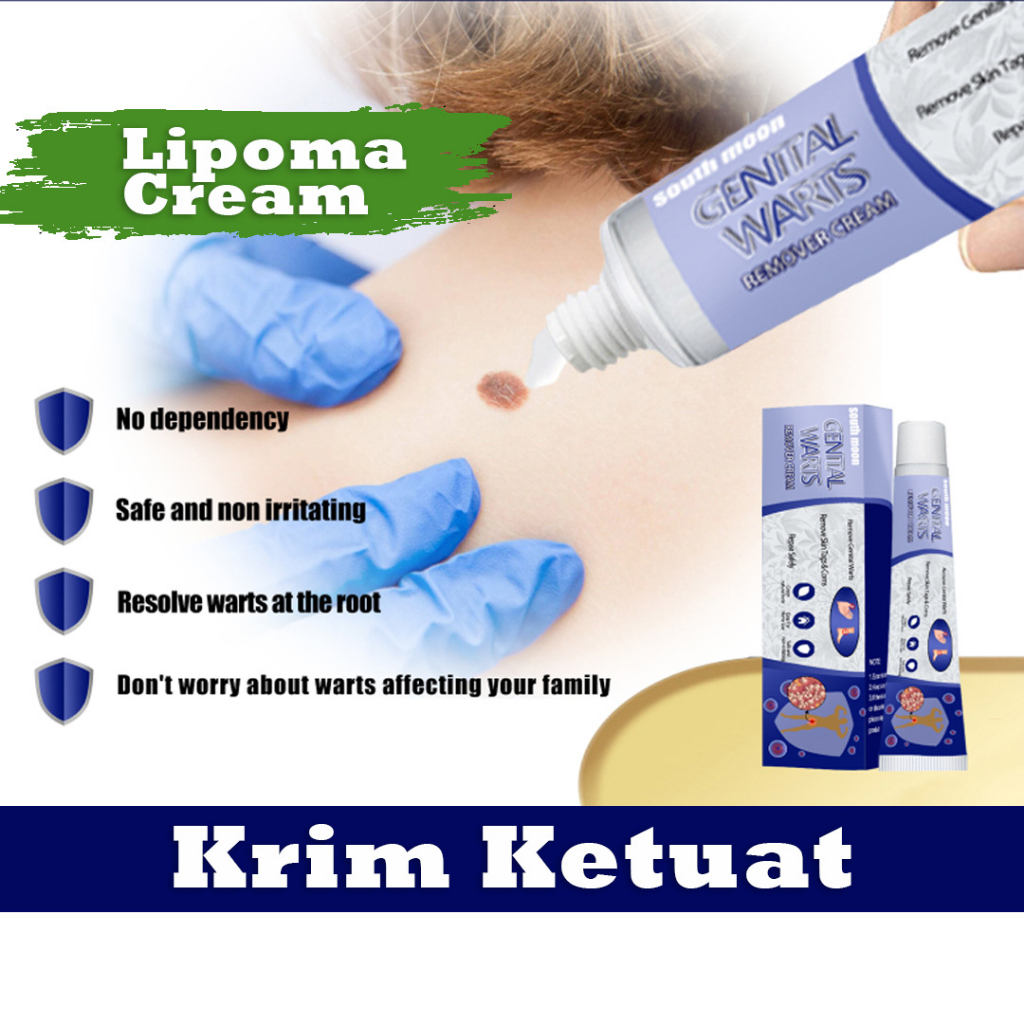 Wart Remover Ubat Kutil Skin Tag Remover Lipoma Removal Cream Buang ...