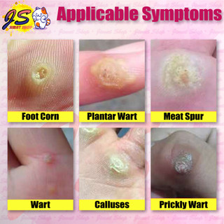 Foot Corn Caps Medicated Plaster Corn Cap Warts Calluses Remover Pads ...