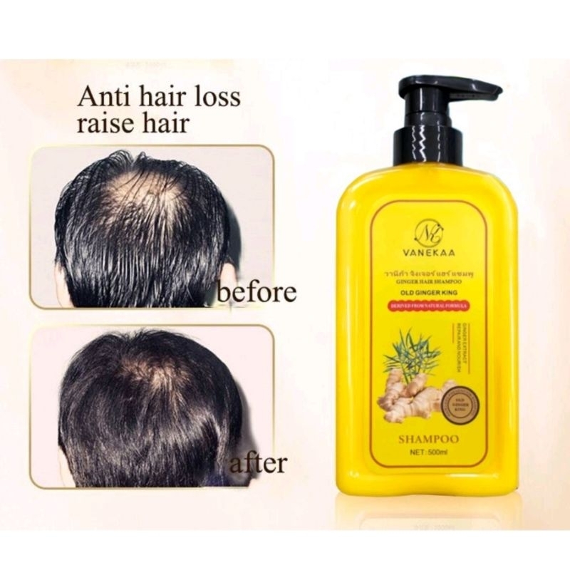 🔥Ready Stock🔥500ml Vanekaa Ginger Hair Shampoo Anti Hair Lost Oil ...