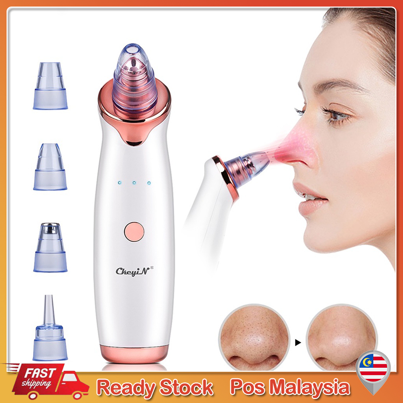 🔥【ready stock】🔥 Blackhead Remover Facial Skin Cleanser Vacuum Suction ...