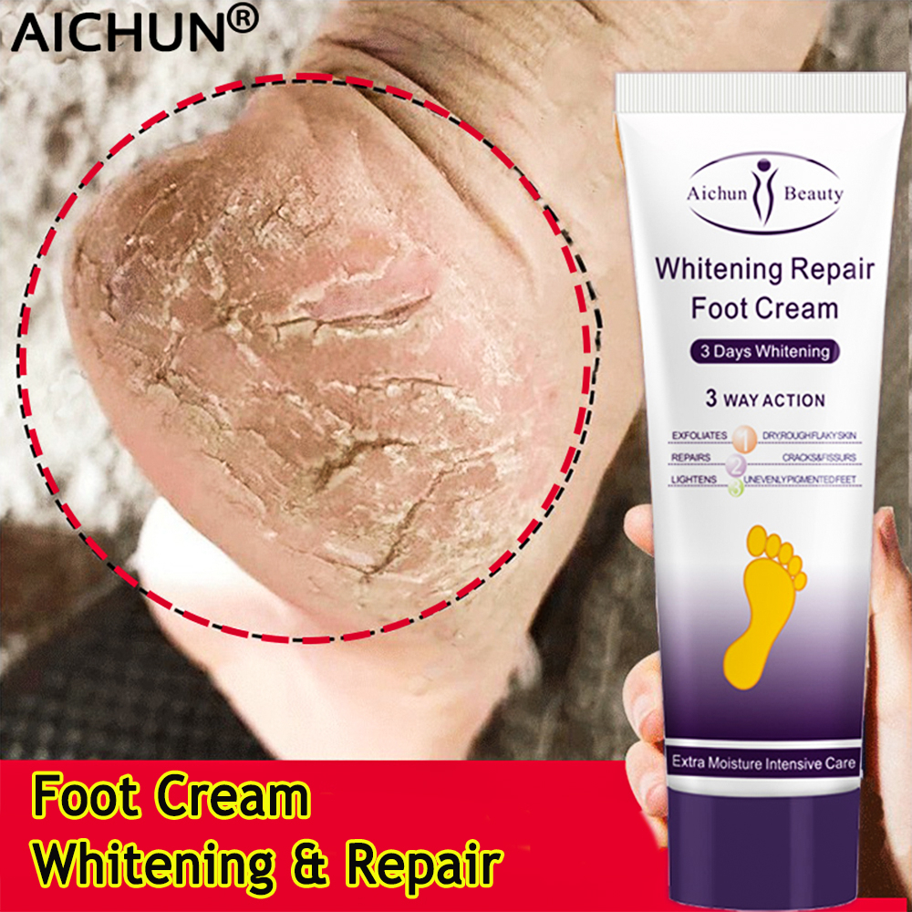 Foot Cream crack heel anti fungal umit kaki merekah Foot Treatment ...