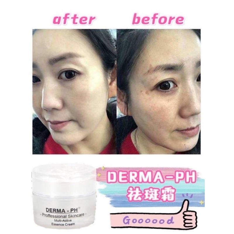 （现货）DERMA -PH ESSENCE CREAM ORIGINAL ( FREE FACE MASK) | Shopee Malaysia