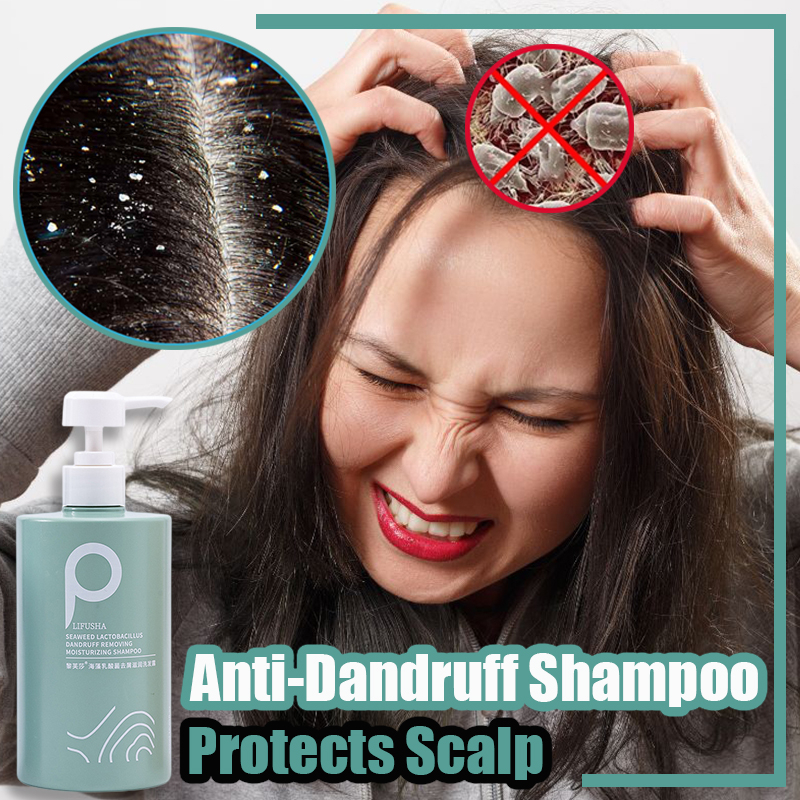 Shampoo kelemumur anti dandruff itchy scalp oil control remove mite Fluffy Strengthens Hair ...