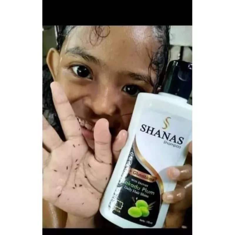 SHAMPO SHANAS ANTI KUTU 170ml HARGA TERJANGKAU DAN READY STOCK MALAYSIA | Shopee Malaysia