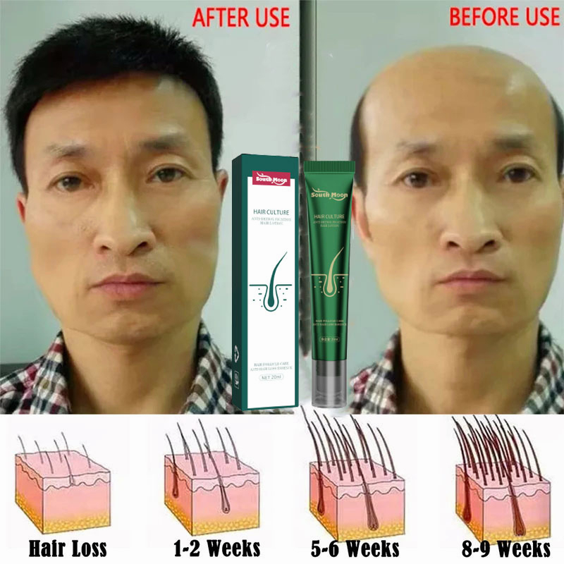 Fast Hair Growth Tonic Serum Ginger Treatment Hair Loss Nourishing