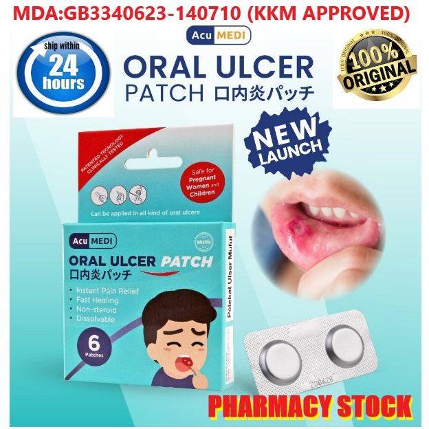 [KKM APPROVED] Oral Ulcer Patch Viral AcuMEDI 6PATCHES (MDA:GB3340623 ...