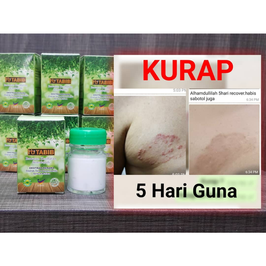 [HQ] KRIM RERAMA HB THABIB UTK SEGALA JENIS MASALAH BERKAITAN KULIT ...