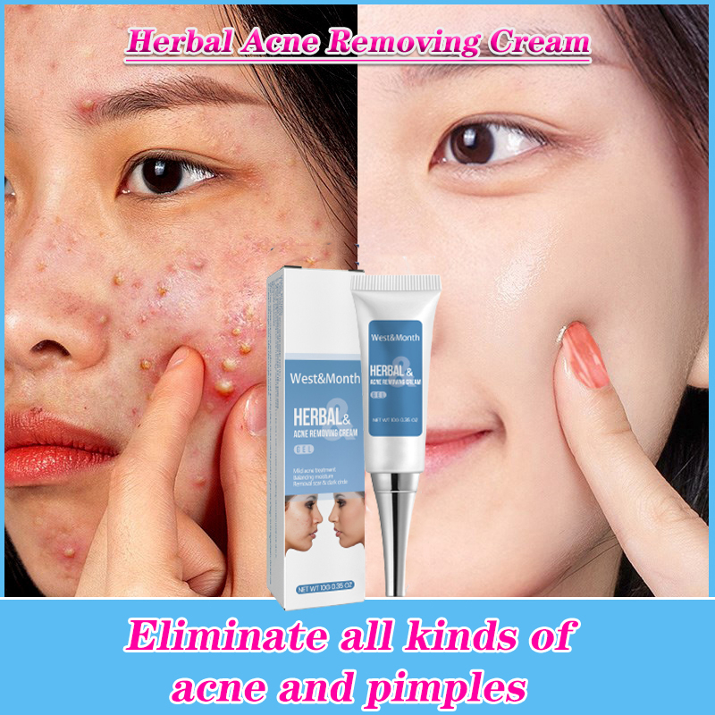Krim parut Jerawat ubat jerawat muka jerawat acne scar treatment acne ...