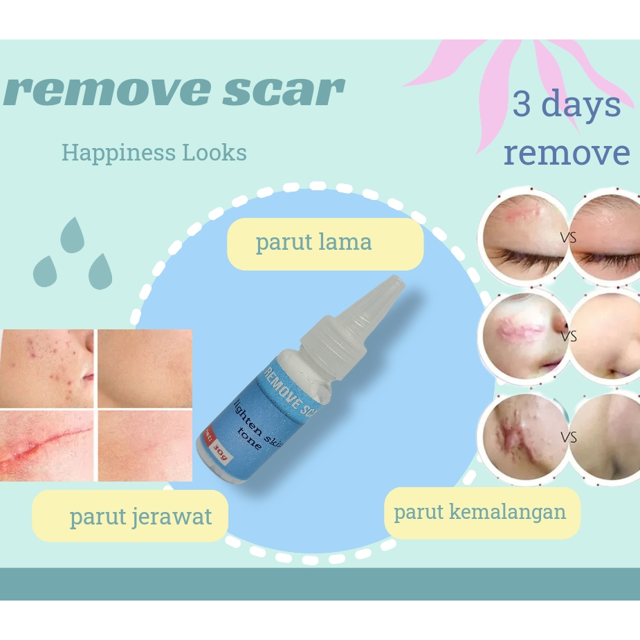 remove scar untuk hilangkan parut dari kesan luka luka kemalangan kesan ...