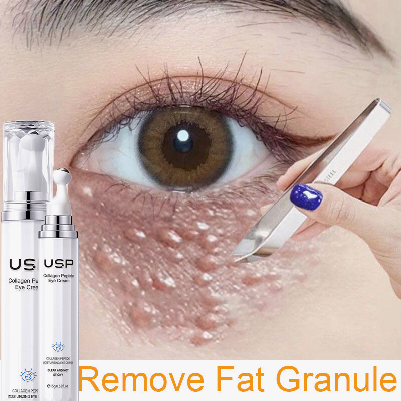 Fat granule remover Eye cream remove repair fat particle Krim mata Anti ...